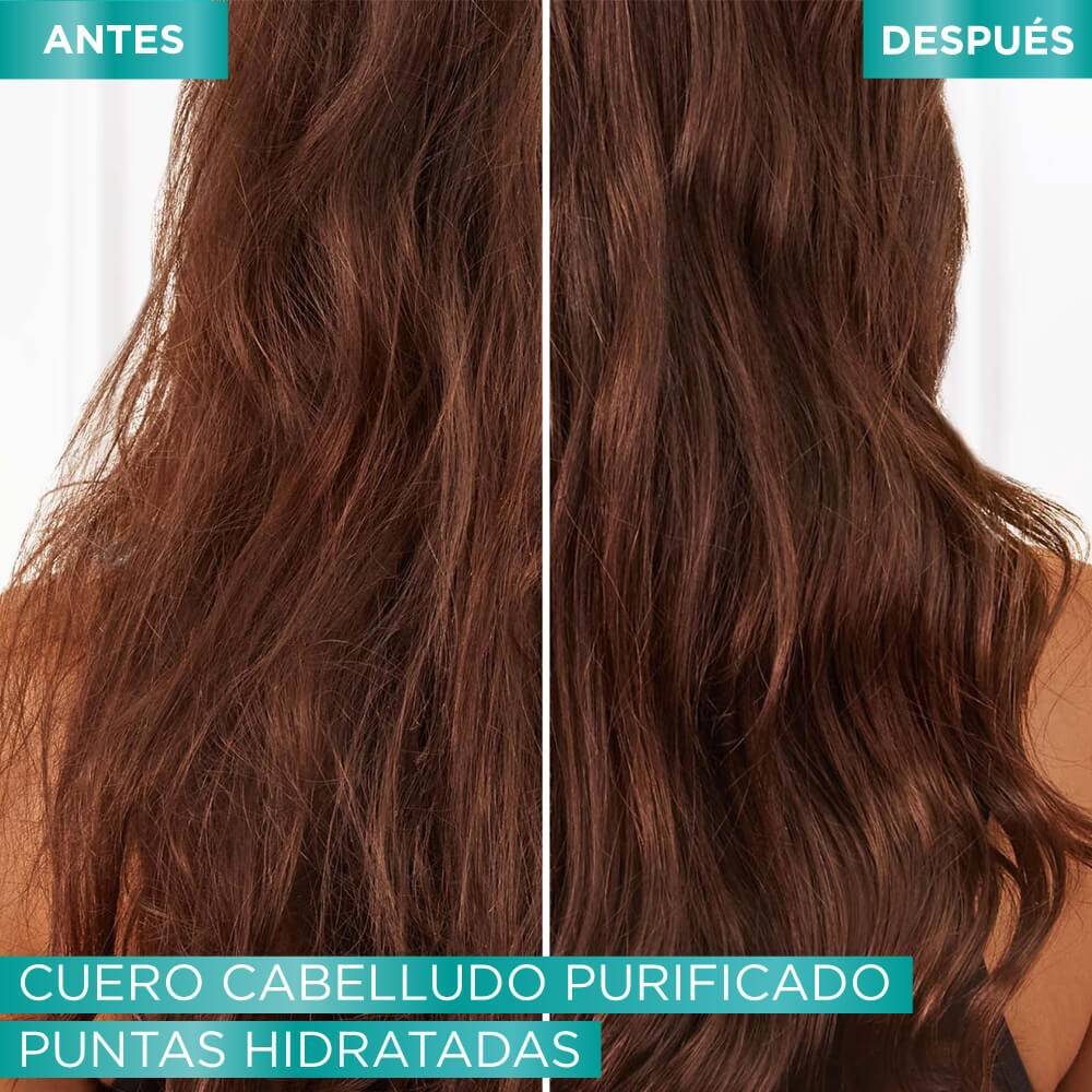 Shampoo Elvive Hialurónico Pure control grasa | L´Oréal Paris